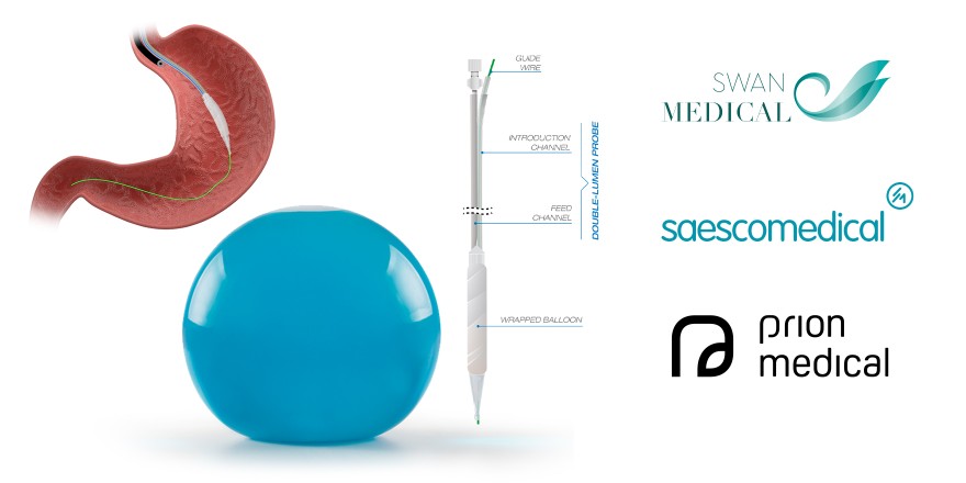 Prion Medical Introduces the Stella Endogastric Balloon in Belgium ...